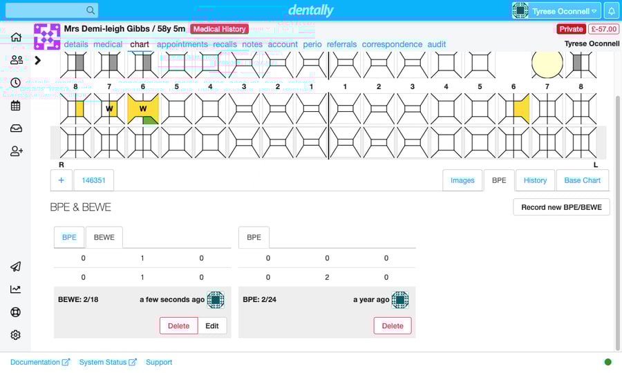Basic Erosive Wear Examinations now in Dentally