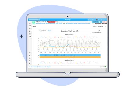 Perio Chart Overview